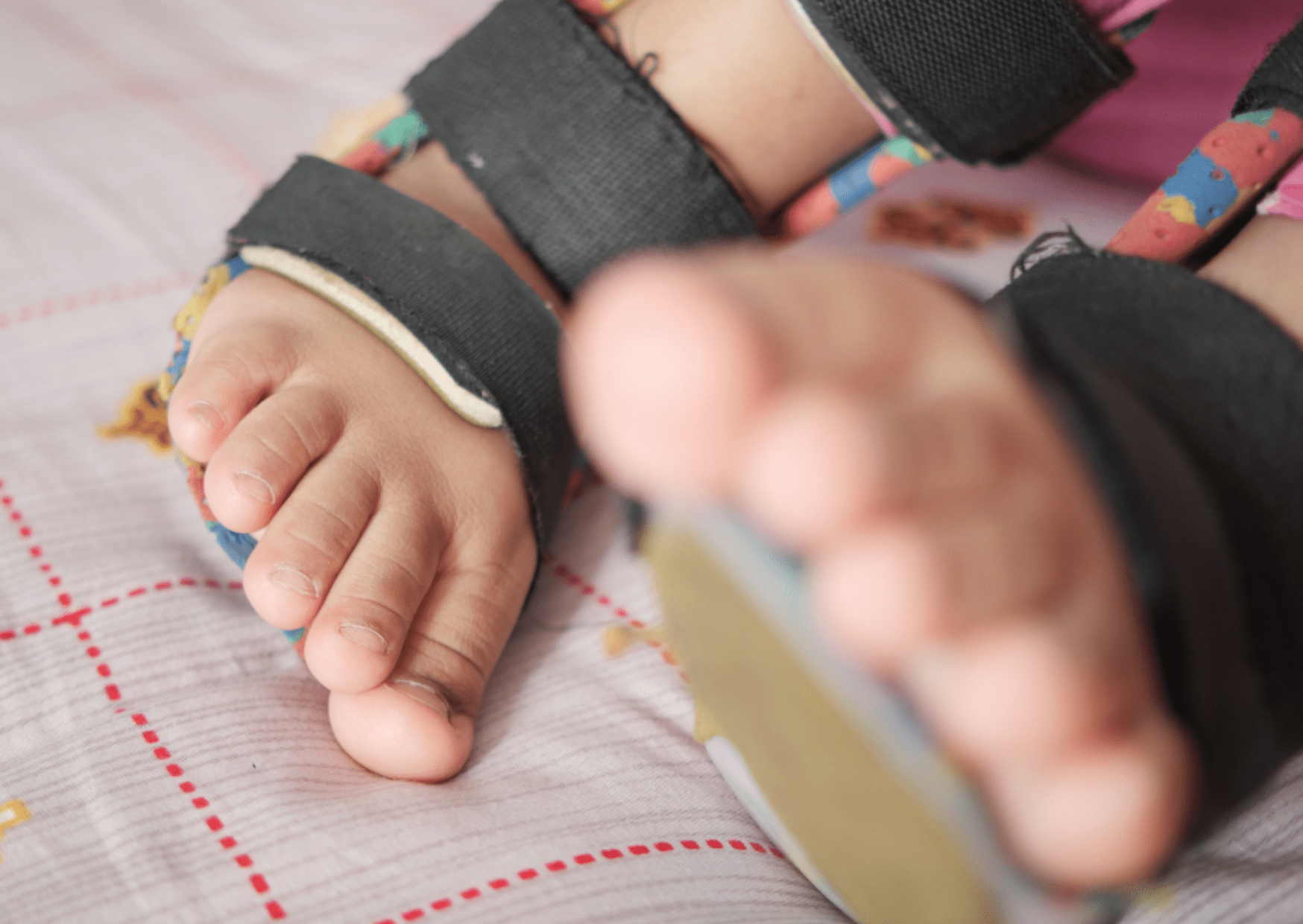 Estrategias Avanzadas para Abordar la Parálisis Cerebral Infantil