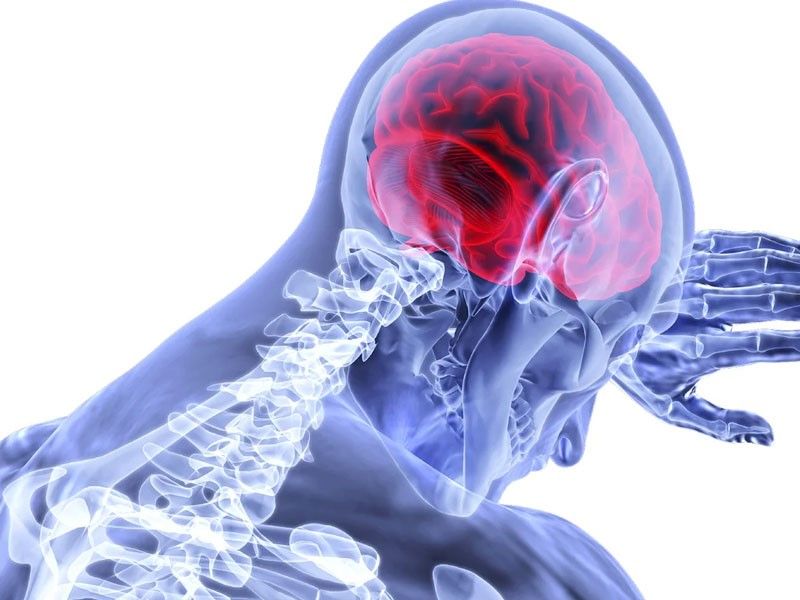 Ataxia ¿Qué es? Clínica Uner